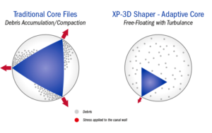 XP-3D Shaper - Next Generation Endodontic Instrumentation