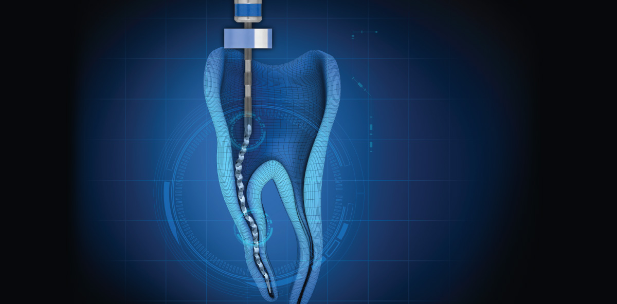 Anatomically Driven Biologic Endodontics, a Free Webinar